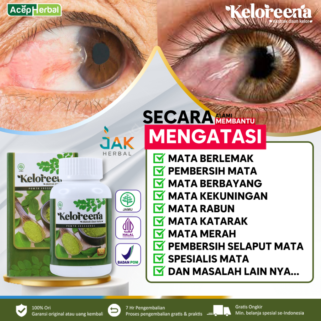 Jual Obat Mata Berlemak Mata Merah Mata Kuning Pembersih Pyterigium ...