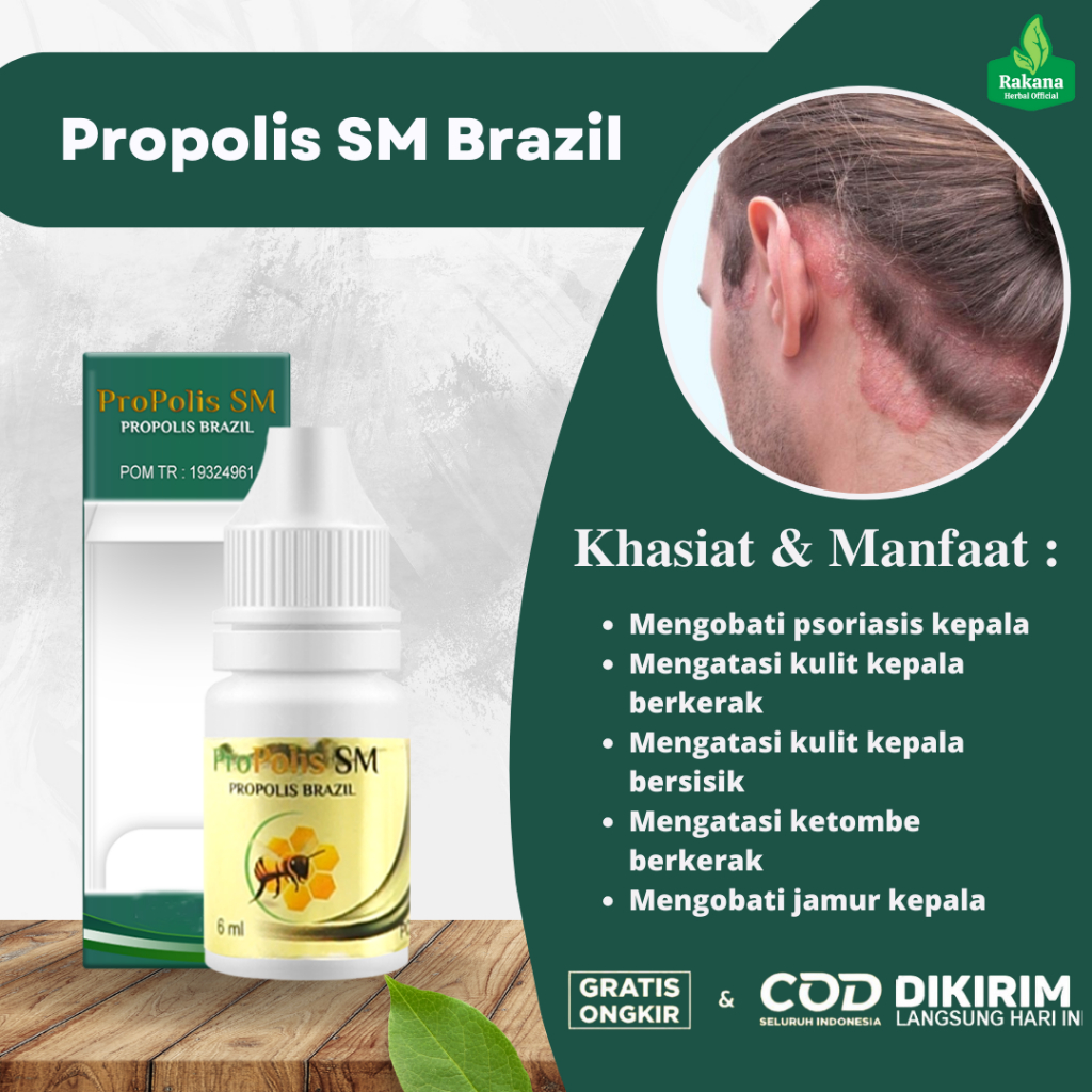 Jual Obat Psoriasis Kulit Kepala, Obat Kulit Kepala Berkerak, Obat ...