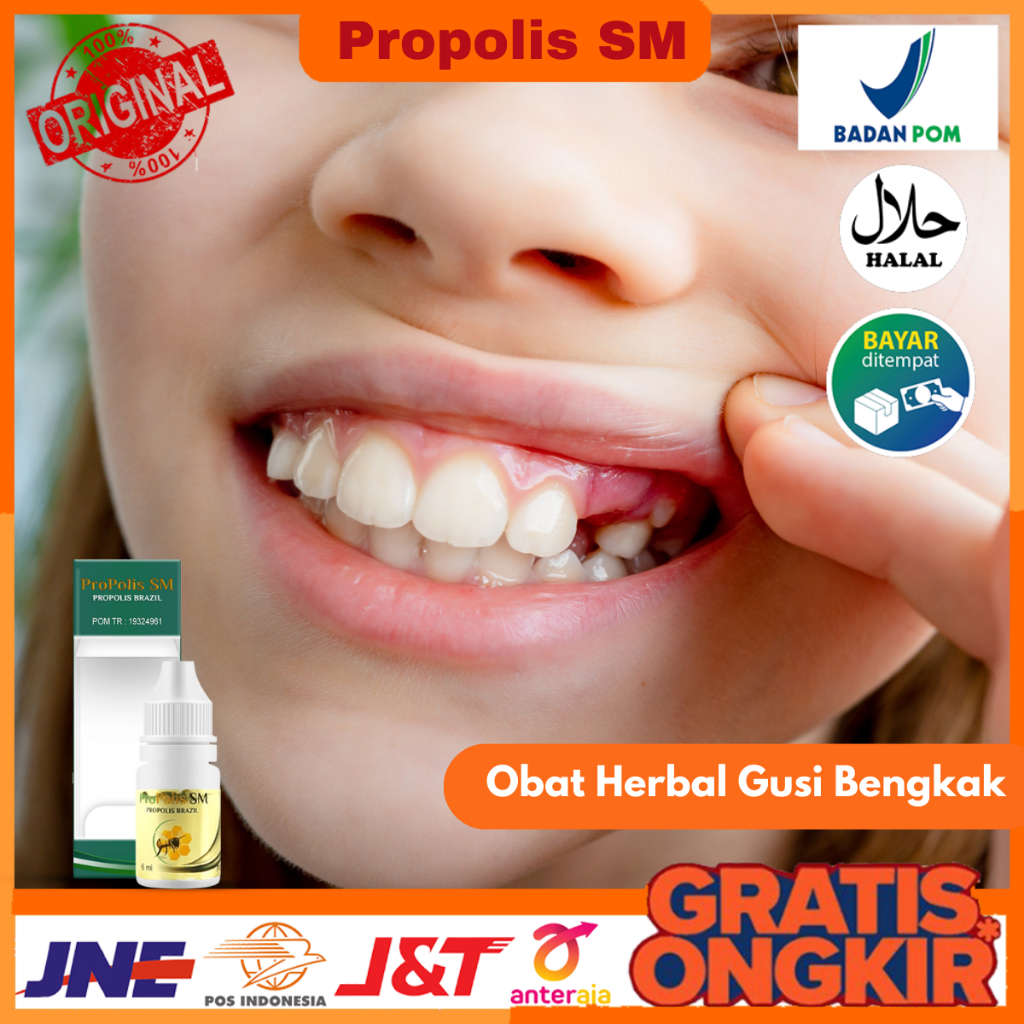 Jual Obat Herbal Gusi Bengkak, Gusi Berdarah, Sakit Gigi - Gigi ...