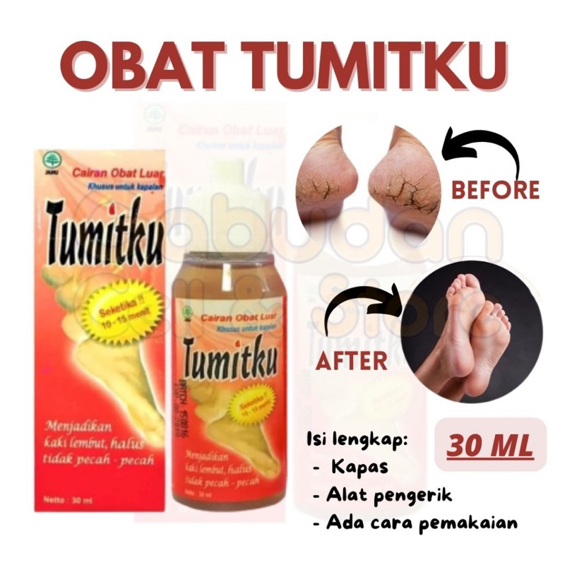 Jual (READY‼️) TUMITKU Obat Herbal Alami Solusi Kaki Pecah-Pecah 30ml ...