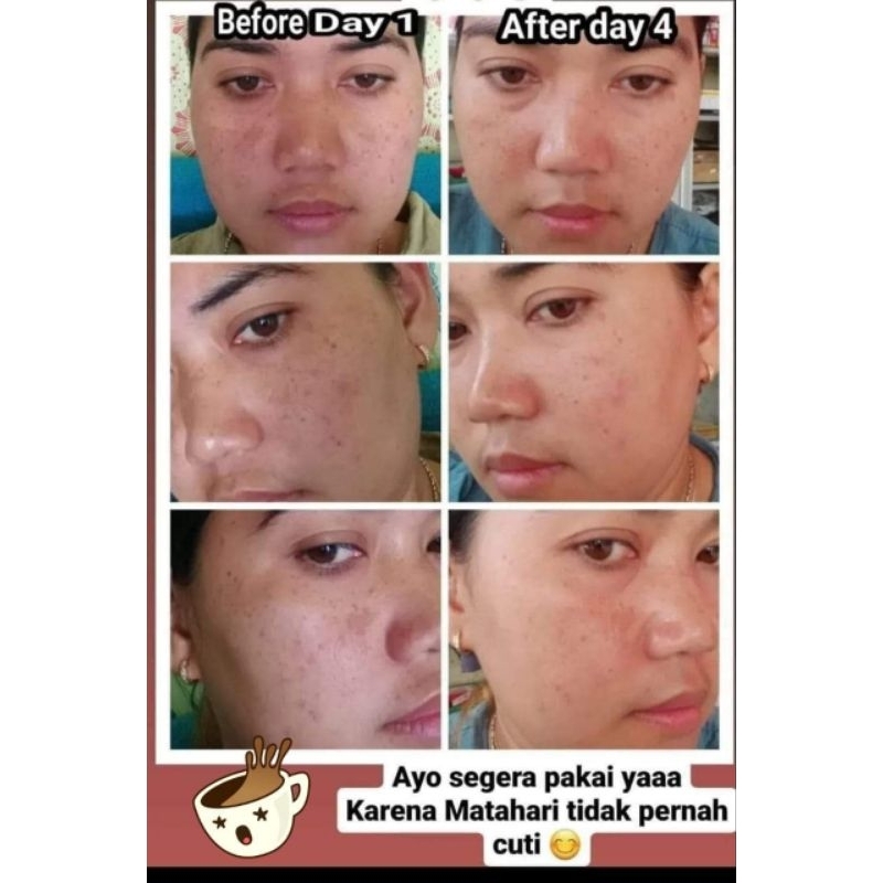 Jual LUMIFACE MCI ORI MASKER KOREA VIRAL | Shopee Indonesia