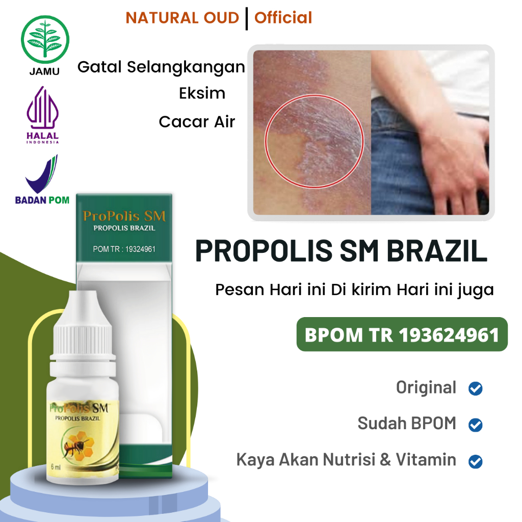 Jual Obat Herbal Selangkangan Hitam Dan Gatal, Kadas, Kurap Gatal Salep ...