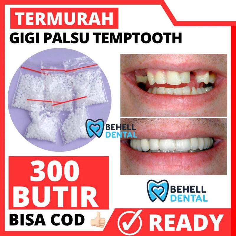 Jual GIGI PALSU SEMENTARA 300 BUTIR / PENAMBAL GIGI PATAH RENGGANG ...
