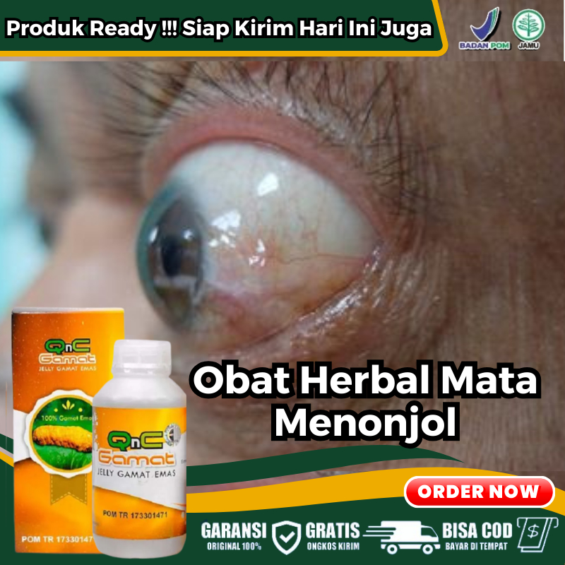 Jual Obat Herbal Mata Menonjol / Mata Besar / Bola Mata Buruk Bengkak ...