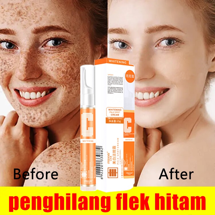 Jual Penghilang flek hitam krim penghilang melasma Vitamin C pen Whitening Freckle Cream 15g ...