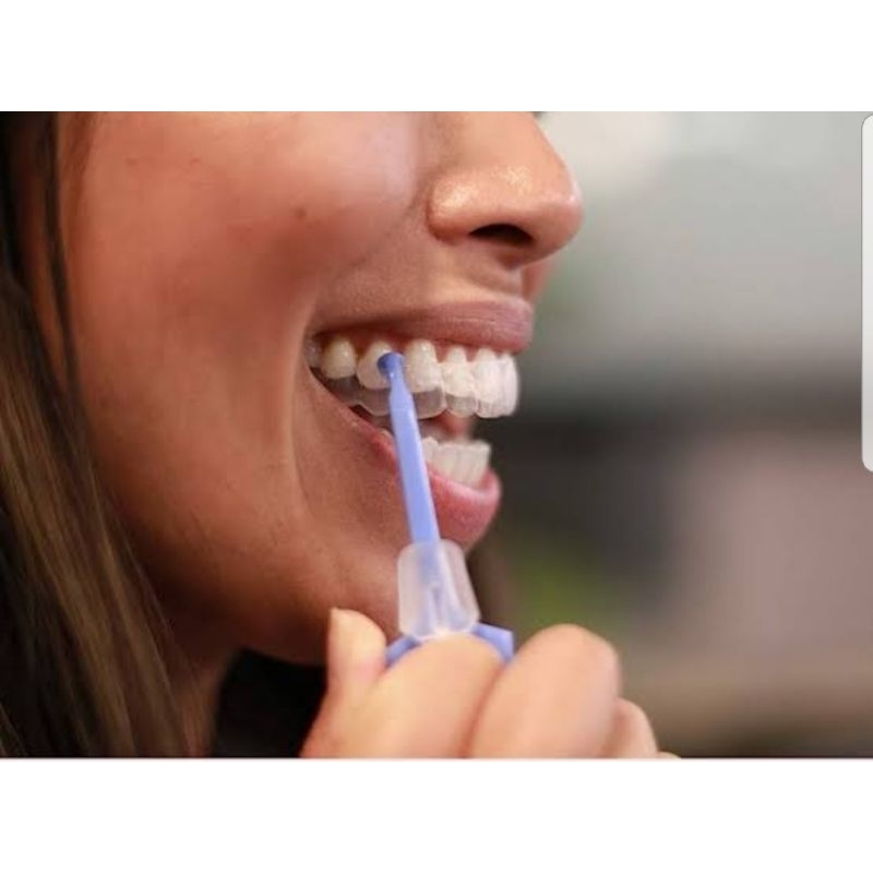 Jual alat lepas retainer orto pembuka retainer aligner orthodontic ...