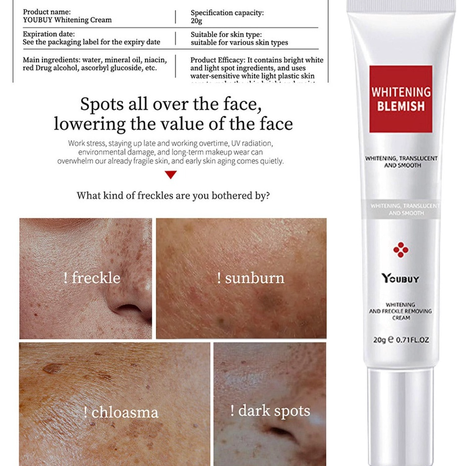 Jual Ready Stock 【BPOM】YOUBUY Whitening Freckle Cream Remove Dark Spots Anti Freckle Cream ...