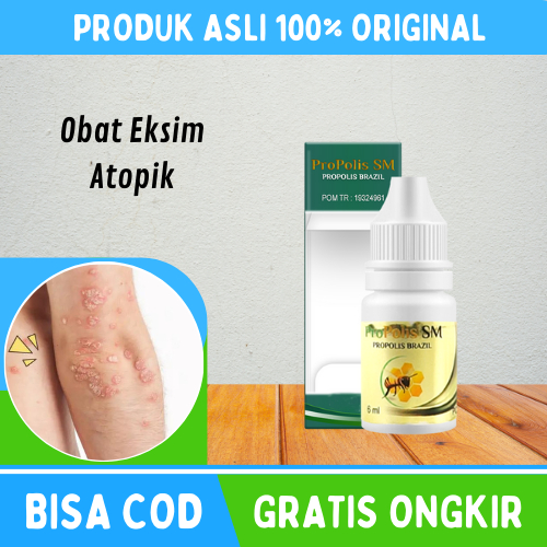 Jual Obat Eksim Atopik, Obat Dermatitis Atopik, Obat Eksim, Obat Eksim ...