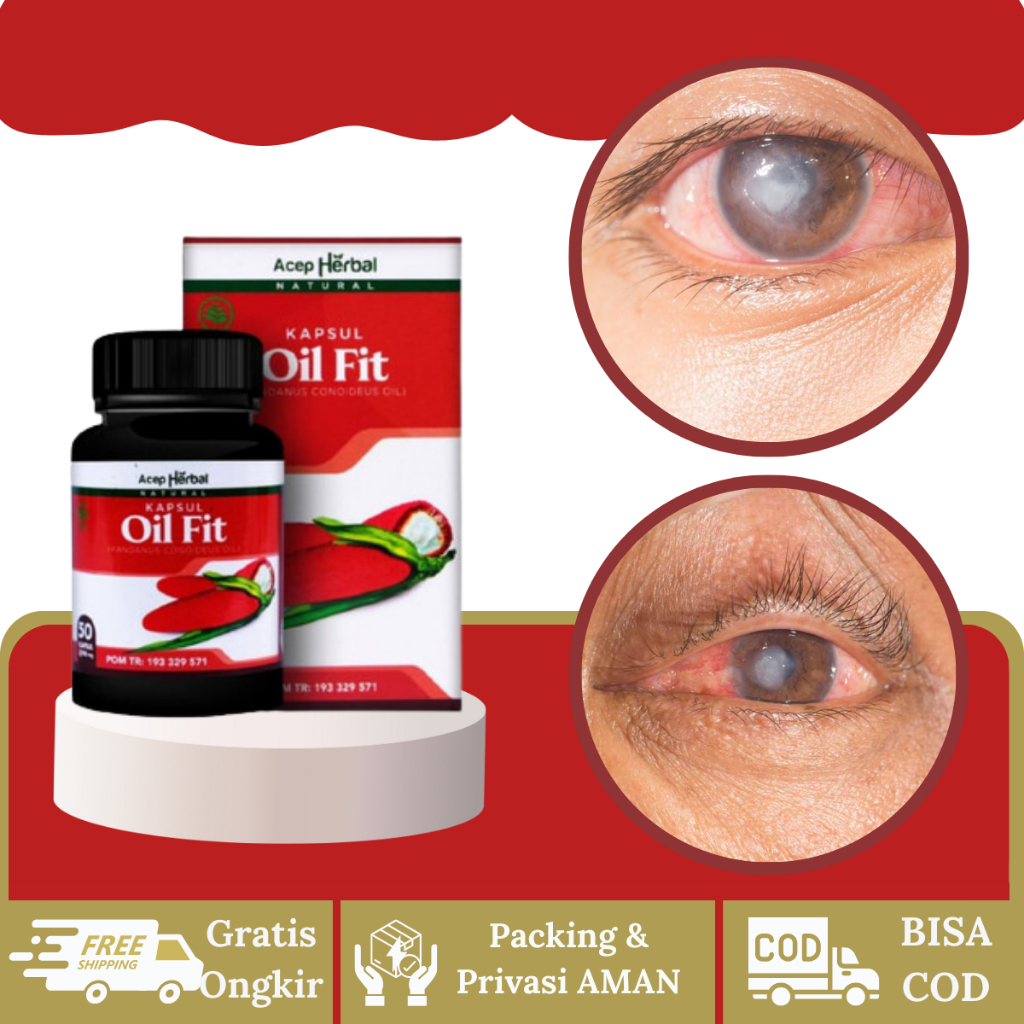 Jual Herbalthy - Obat Ulkus Kornea Mata - Obat Mata Berlendir - Oil Fit ...