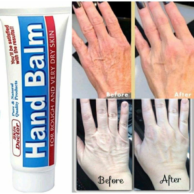 Jual HAND BALM herbal skin dokter ( pure and natural quality produk ...