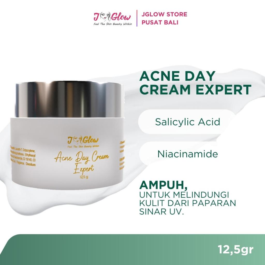 Jual Jglow Acne Day Cream Expert (Membantu Melindungi Wajah Dari Sinar ...