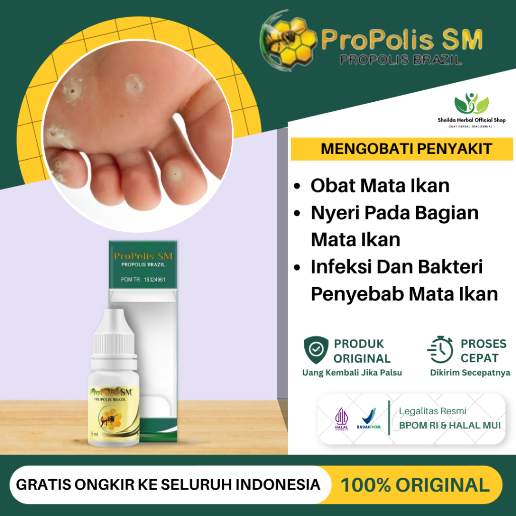 Jual Obat Tetes Perontok Mata Ikan di Telapak Kaki, Obat Mata Ikan ... Jual Obat Tetes Perontok Mata Ikan di Telapak Kaki, Obat Mata Ikan ...