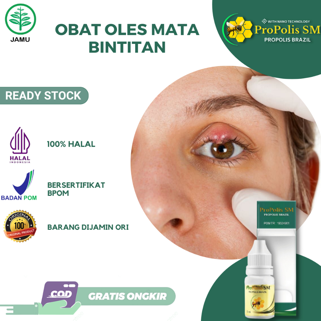 Jual Obat Mata Bengkak Obat Mata Bintitan Benjolan Kalazion Benjolan ...