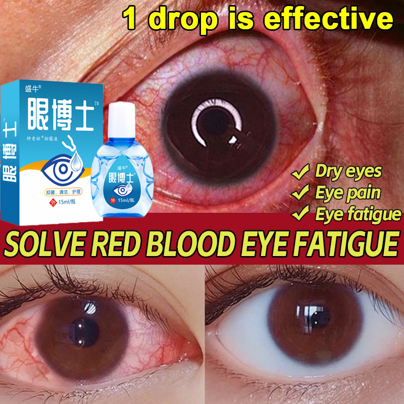Jual obat tetes mata Obat mata obat mata katarak Eye Drops Mata Merah ...