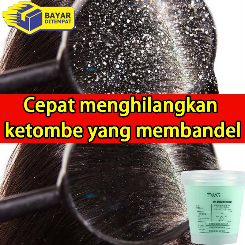 Jual Sea Salt shampoo anti ketombe Dan Gatal Sampo Garam Laut, Anti Gatal Anti Ketombe, 250g ...