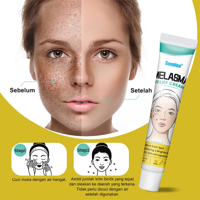 Jual Salep khusus untuk vitiligo 20g vitiligo/penyakit kulit putih/panu ...