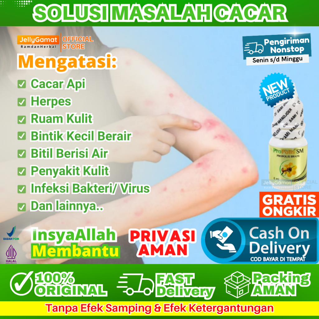 Jual Obat Cacar Api, Cacar Air, Obat Herpes Genital, Herpes Zoster ...