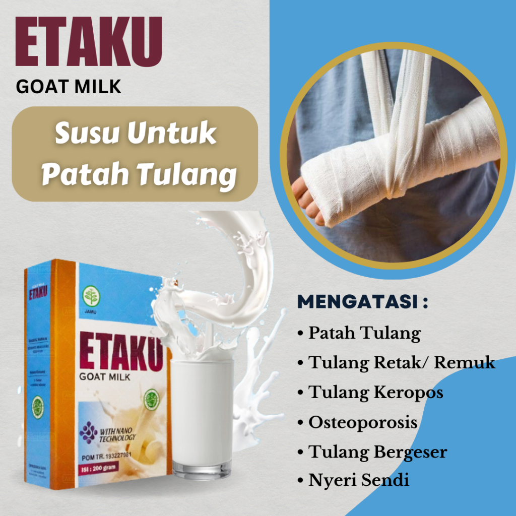 Jual Susu Untuk Patah Tulang, Penyambung Tulang Patah, Susu Untuk ...
