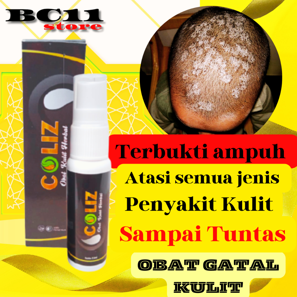 Jual Herbal Coliz Obat Gatal Paling Ampuh Selangkangan Kulit Gatal Panu Kadas Borok Kurap ...