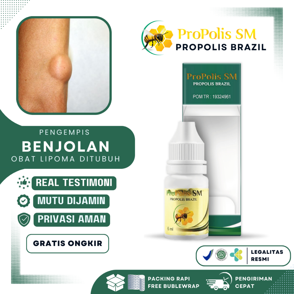 Jual Salep Oles Penghilang Benjolan Di Leher Kelenjar Getah Bening Obat ...