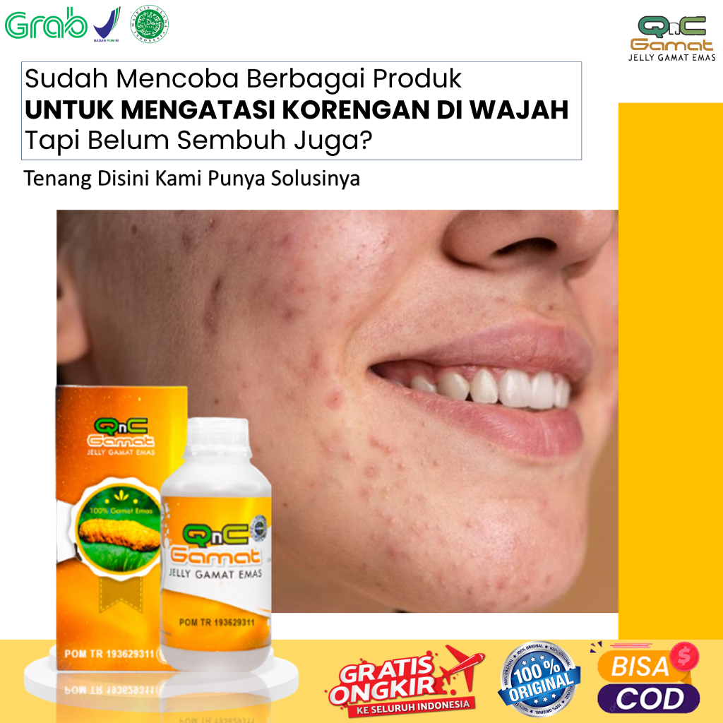 Jual Obat Penghilang Koreng Bekas Koreng Di Wajah Kaki Dan Tangan ...
