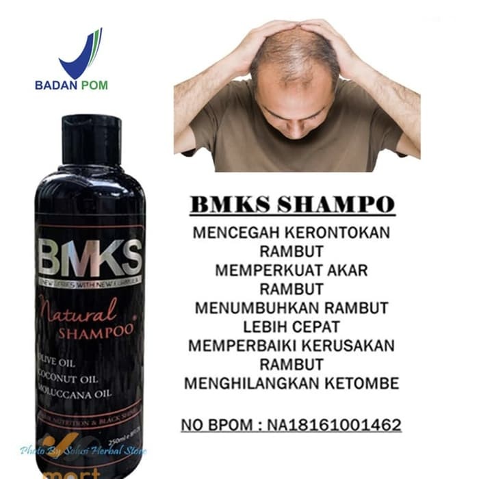 Jual Obat Penumbuh Rambut Botak Pelebat Rambut Rontok Penyubur Rambut ...