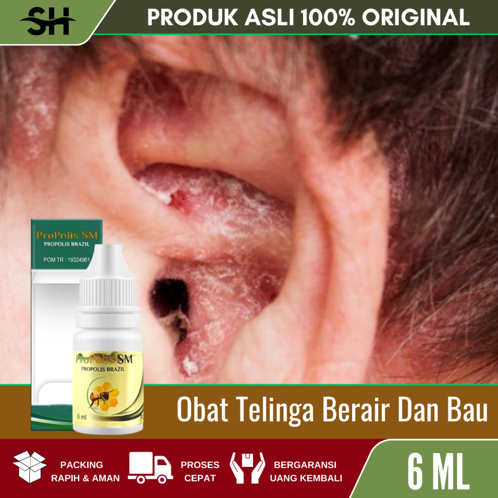 Jual Obat Tetes Telinga Berair dan Bau, Kuping Gatal, Obat Curek Untuk ...