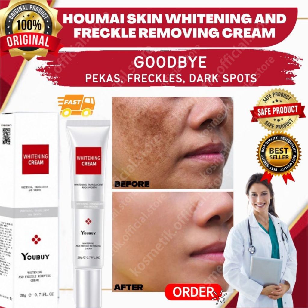 Jual Whitening Freckle Cream Remove Dark Spots Anti Freckle Cream Niacinamide Fade Pigmentation ...