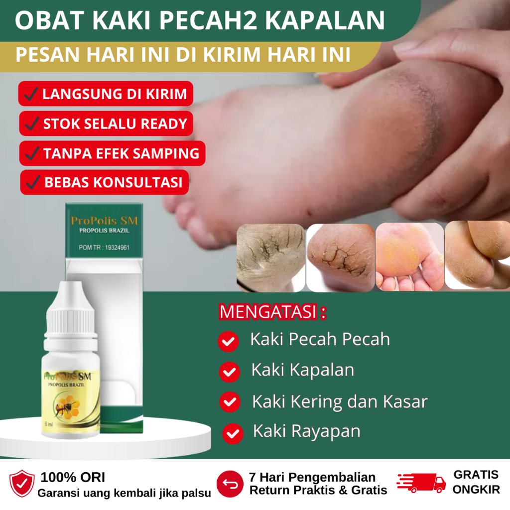 Jual Obat Kaki Pecah Pecah, Obat Penghilang Luka di Kaki, Obat Kaki ...
