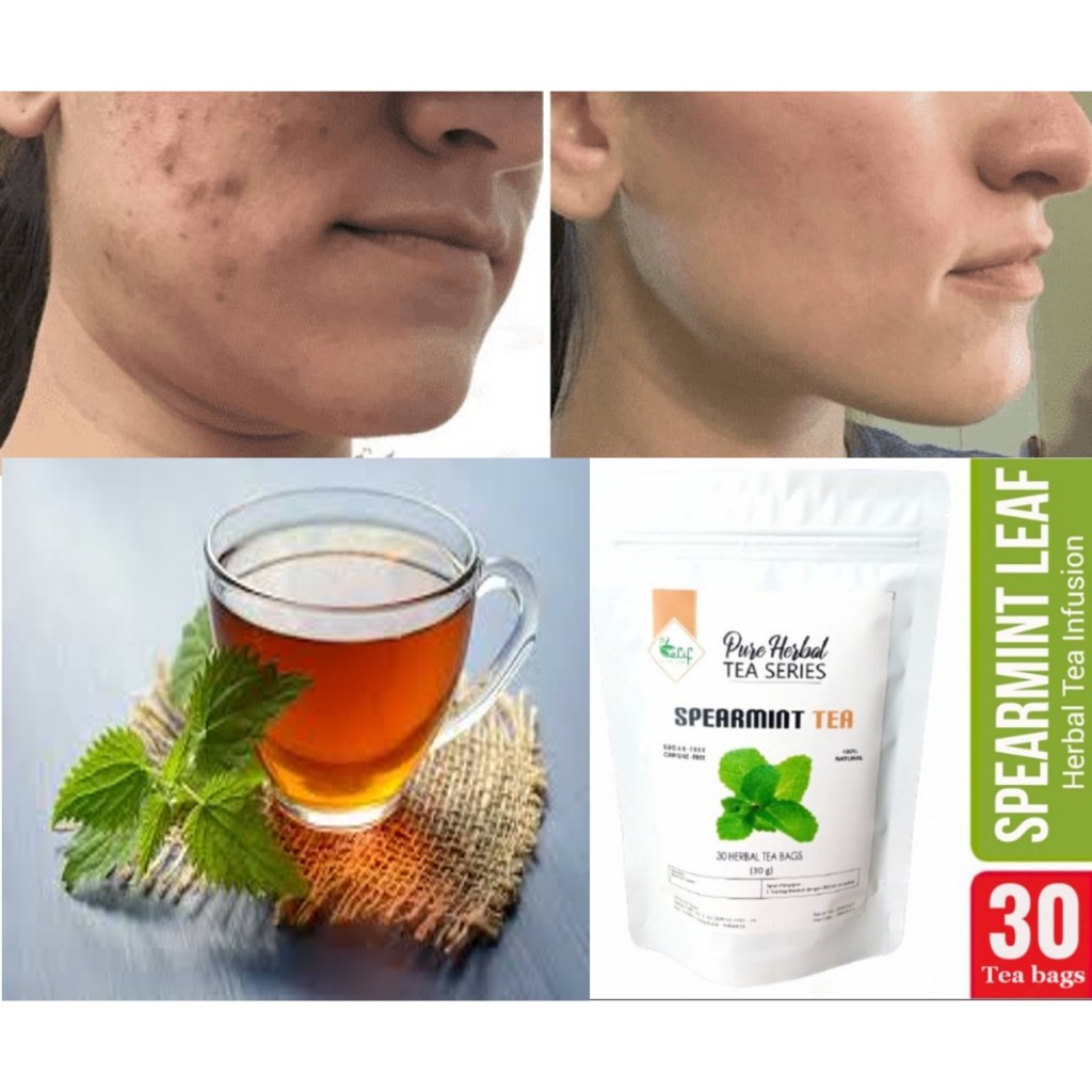 Jual Spearmint Tea Jerawat Hormonal Acne Teh Spearmint 30 Kantung Teh Ijin Dinkes PIRT | Shopee ...