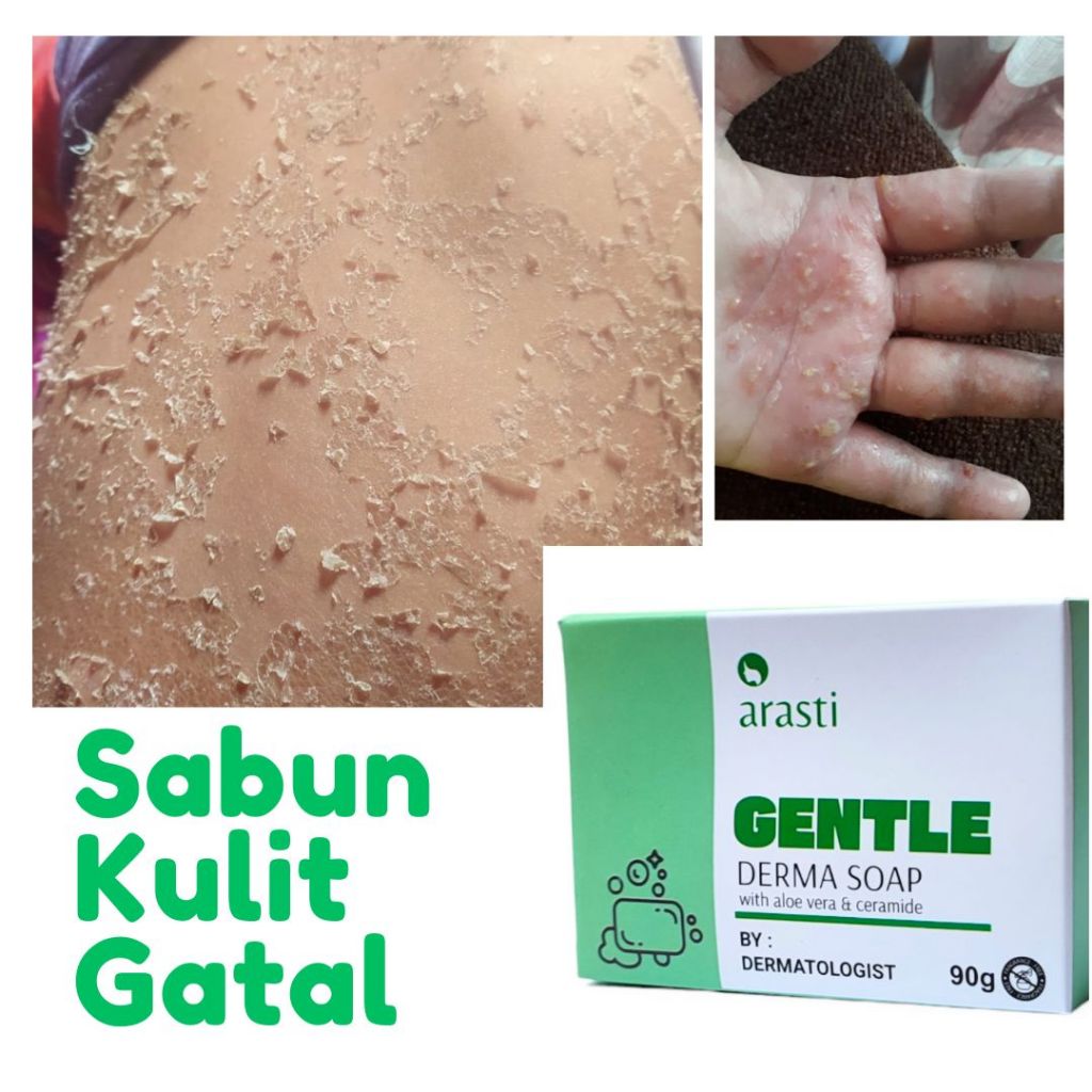 Jual ARASTI Gentle Derma Soap - Sabun Kulit Gatal, Berjerawat, & Kulit ...