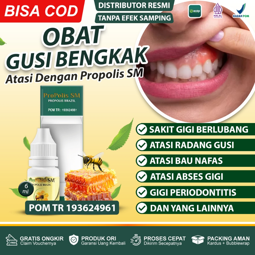 Jual Obat Gusi Bengkak Sakit Gigi Gigi Berlubang Radang Gusi Gigi ...