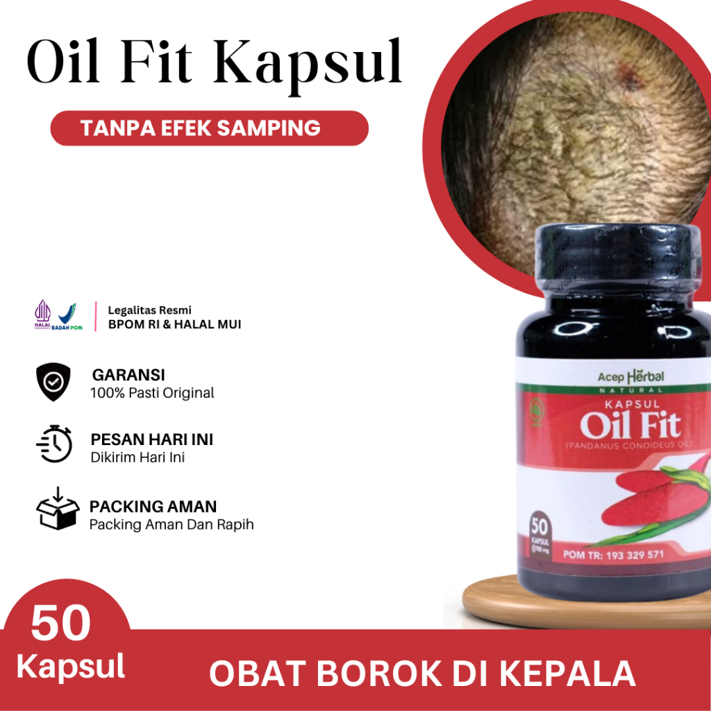 Jual Obat Borok Di Kepala, Korengan Di Kepala, Jamur di Kulit Kepala ...