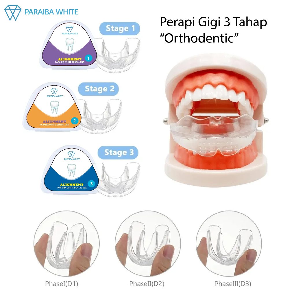 Jual Perapi Gigi - Teeth Trainer Allignment - Orthodentic Retainer ...