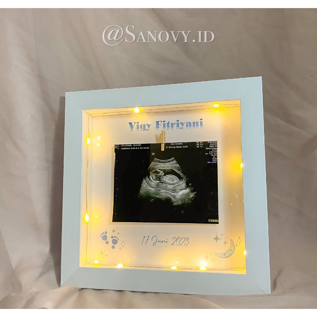 Jual 2020012 Pigura / frame 3d USG Baby Photo Frame | Shopee Indonesia