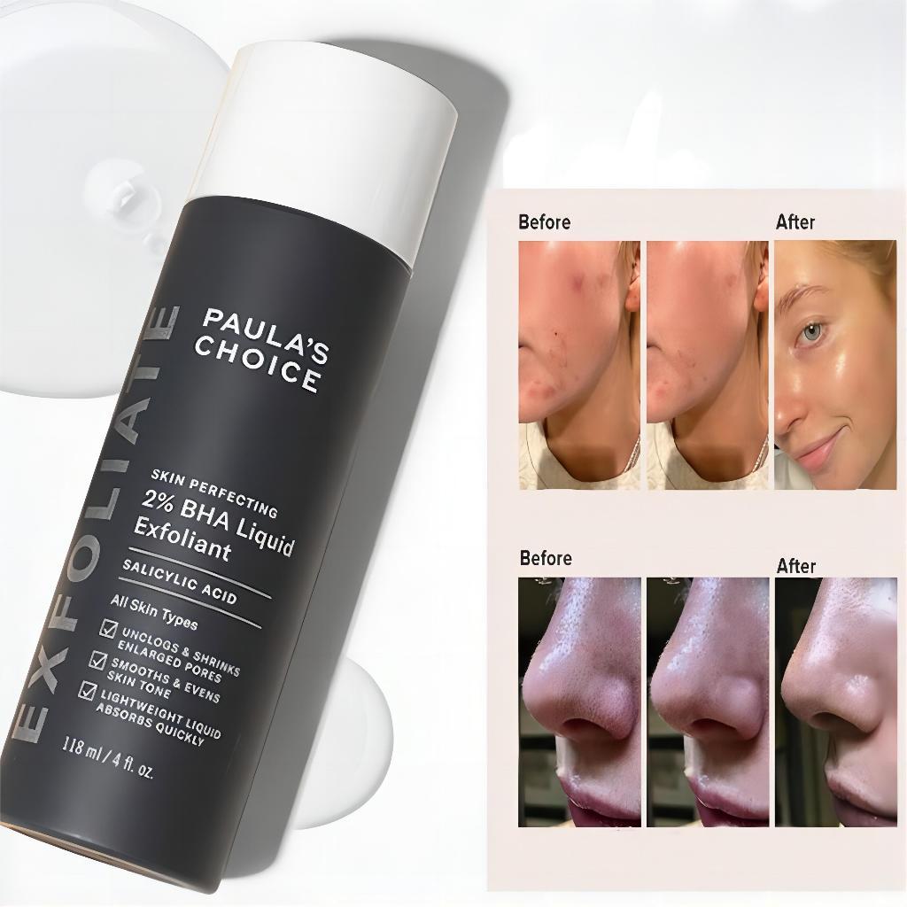 Jual PAULA'S CHOICE Skin Perfecting 2% BHA Liquid Exfoliant (Paulas ...