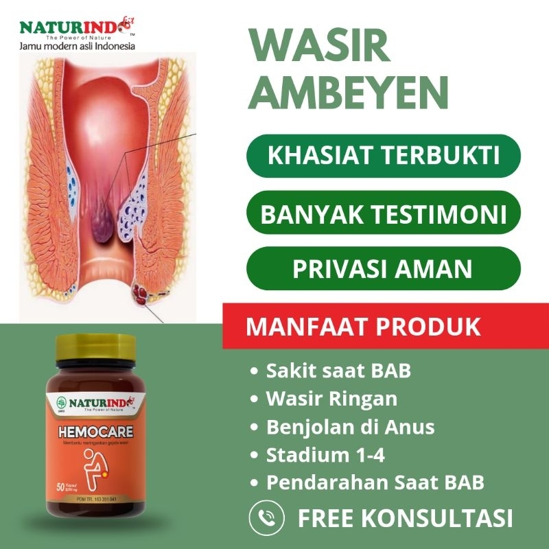 Jual Obat Wasir Ambeyen Ambeien Benjolan Di Anus Luar Dalam Stadium 1-4 Paling Ampuh Hemocare ...