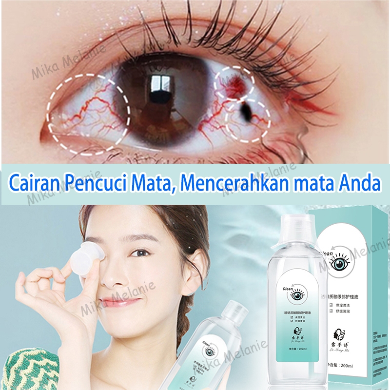 Jual Eye Flush Pencuci Mata Eye Flush 200ml Cairan Pencuci Mata Asam ...