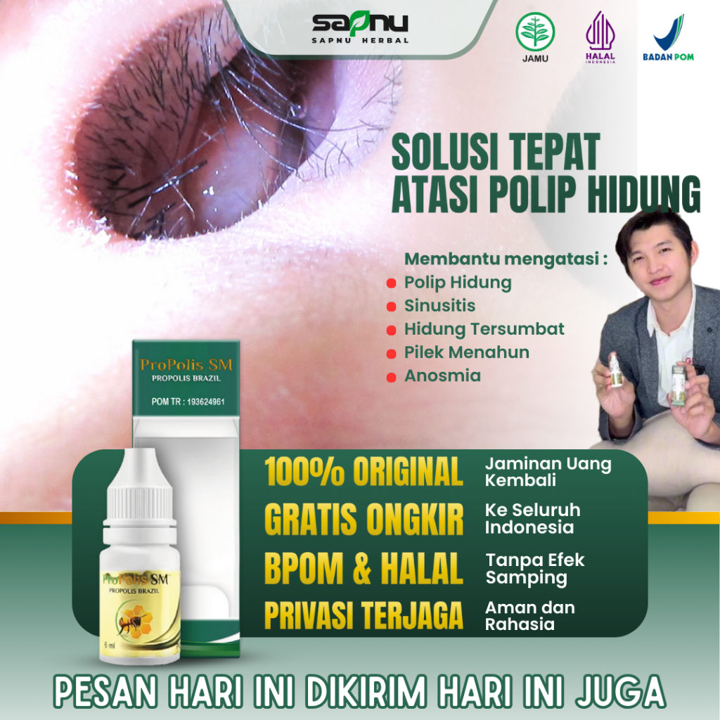 Jual Obat Polip Hidung, Obat Polip Hidung Semprot, Polip Hidung Untuk ...