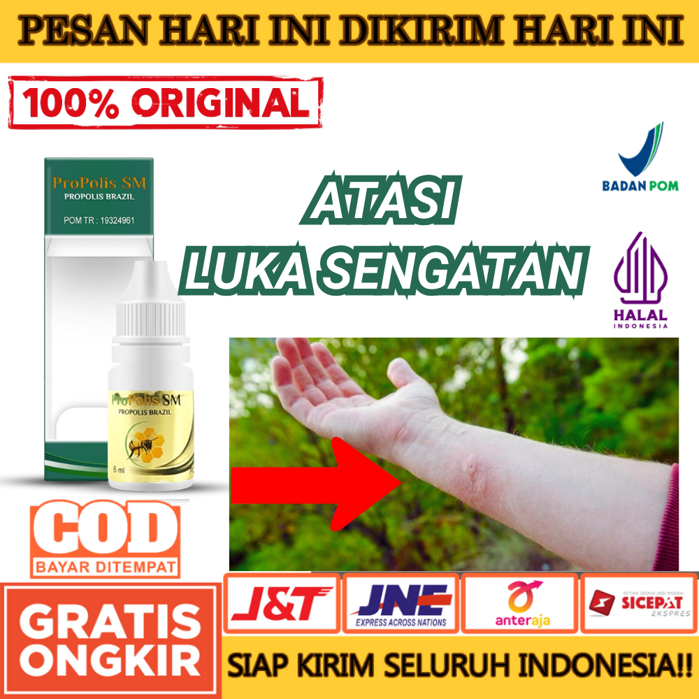 Jual Obat Luka Akibat Disengat Tawon, Luka Sengatan Lebah, Luka Bengkak ...