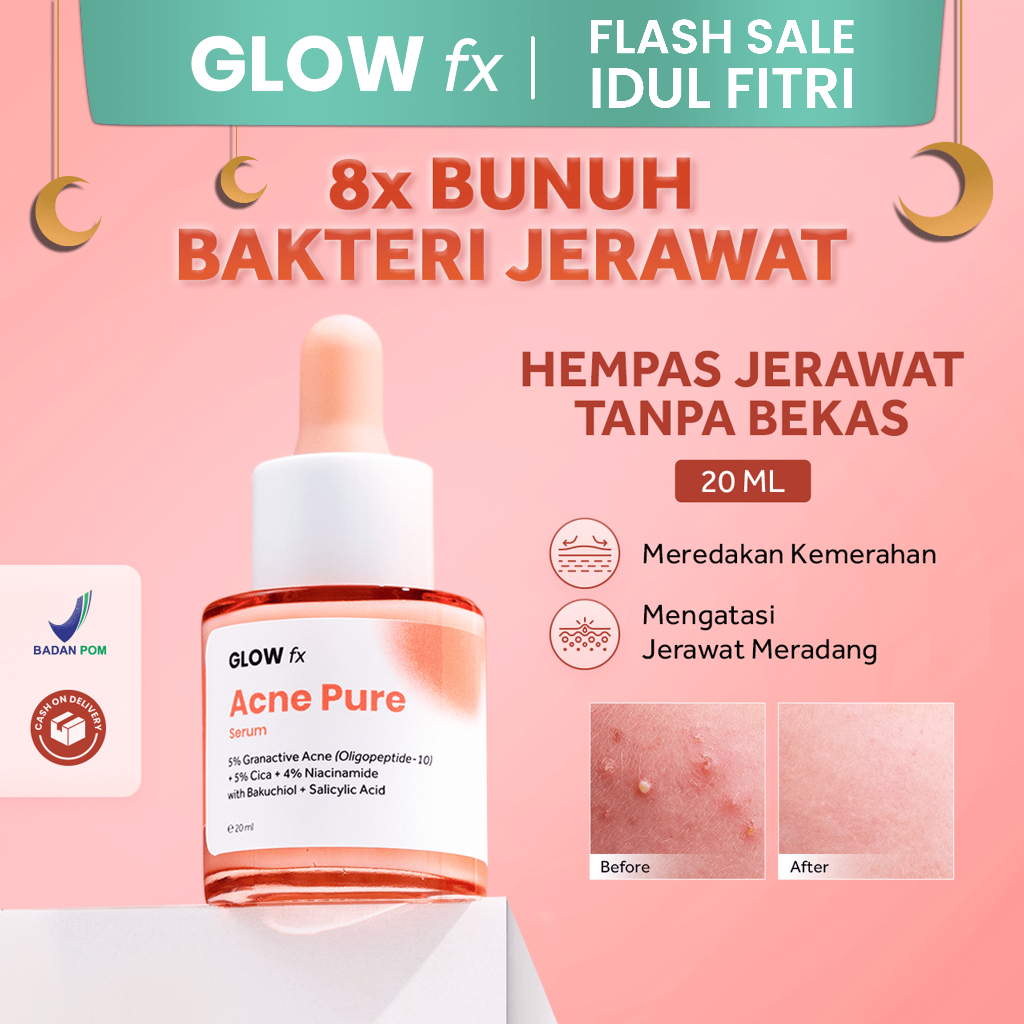 Jual GLOW FX Acne Pure Serum - Serum Untuk Jerawat Meradang | Shopee ...