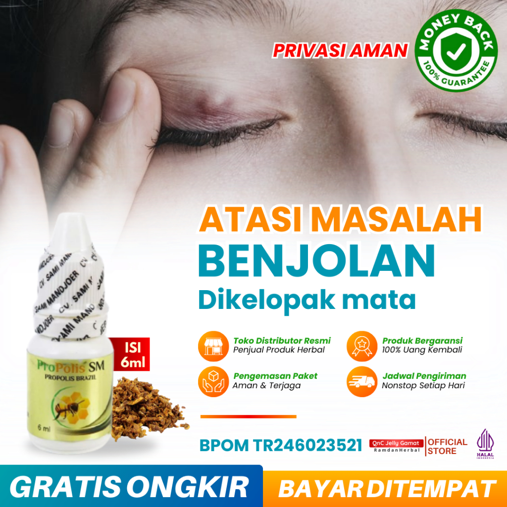 Jual Propolis Sm - Obat Tetes Herbal Penghilang Benjolan Di Kelopak ...