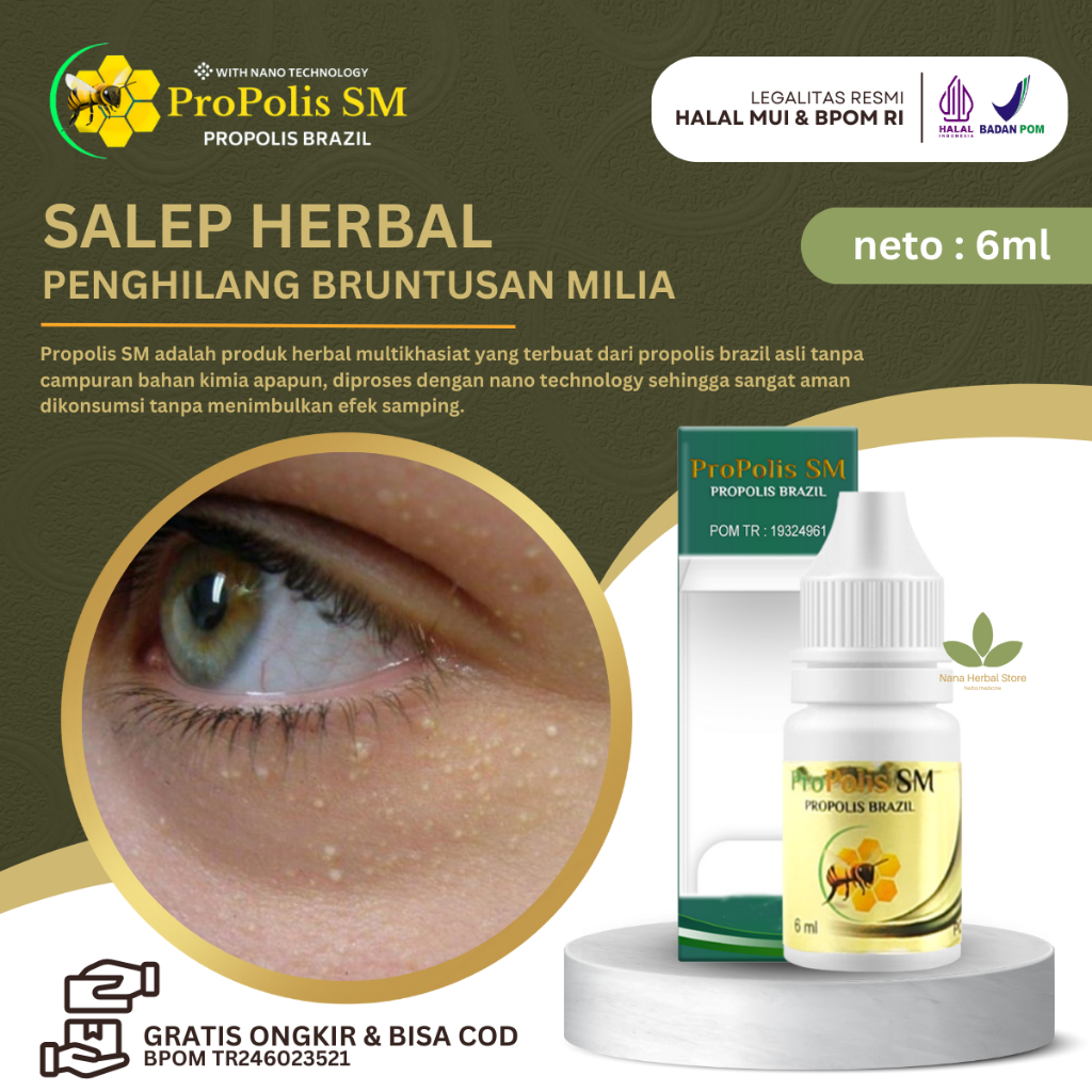 Jual Propolis SM Brazil 6ml Obat Oles Penghilang Milia Bintik Putih di ...