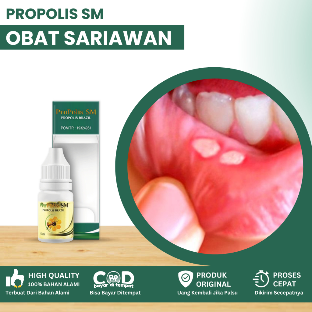 Jual Obat Sariawan Akut, Obat Sariawan Parah, Radang Sariawan, Obat ...