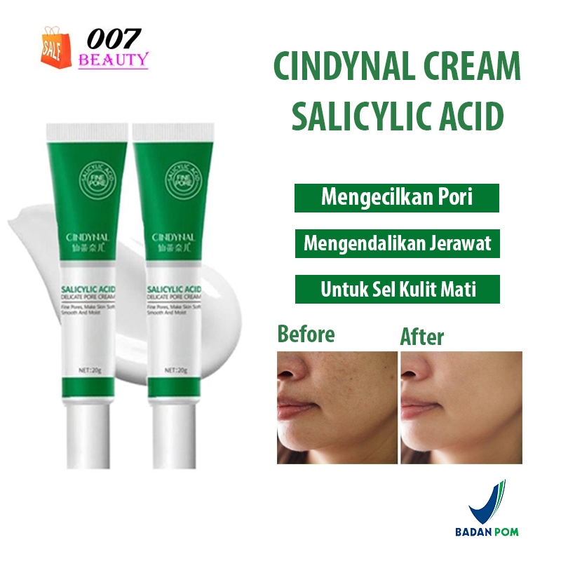 Jual BPOM CINDYNAL Cream Pori Wajah/Jerawat Salicylic Acid 20ml | Shopee Indonesia