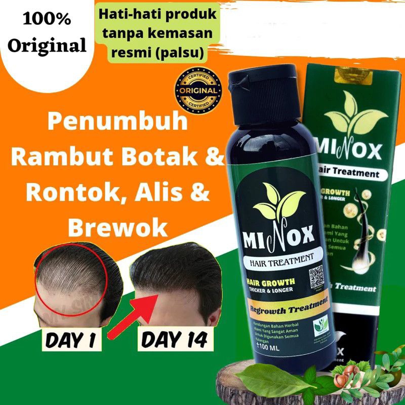 Jual MINOX Treatment Penumbuh Rambut Botak Rontok, dan Tipis & Brewok ...