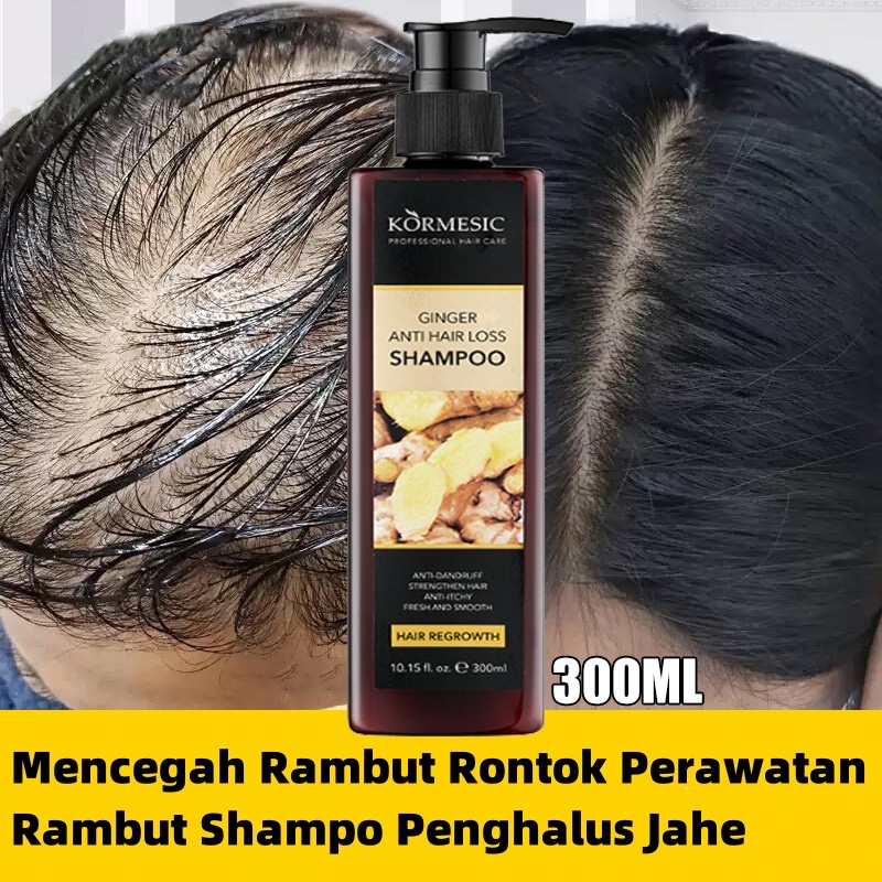 Jual Shampo Penumbuh Rambut cepat Shampo anti rontok 300ml sampo anti ketombe dan rontok Anti ...