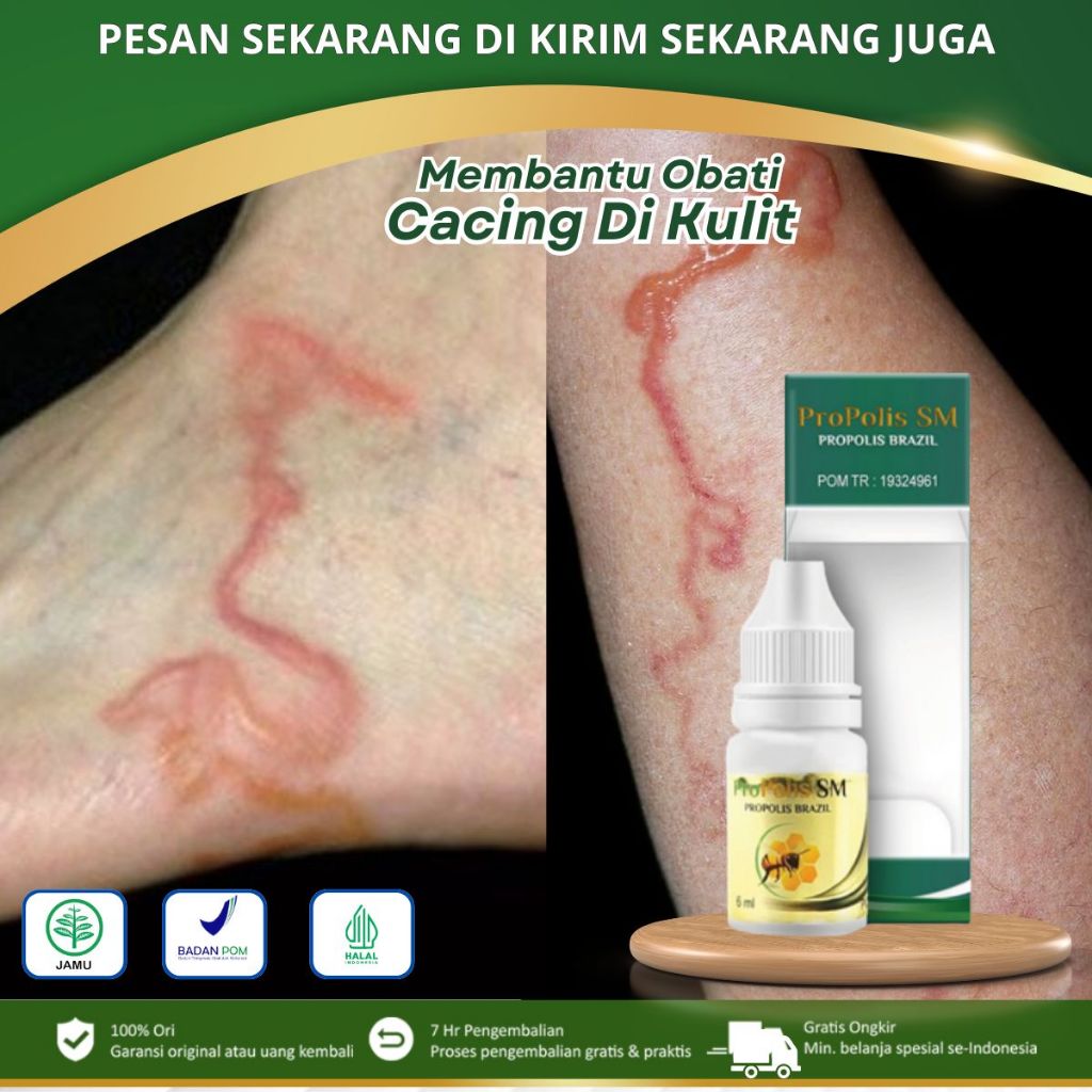 Jual Propolis SM Brazilian - Obat Khusus Cacing Larva, Obat Penghilang ...