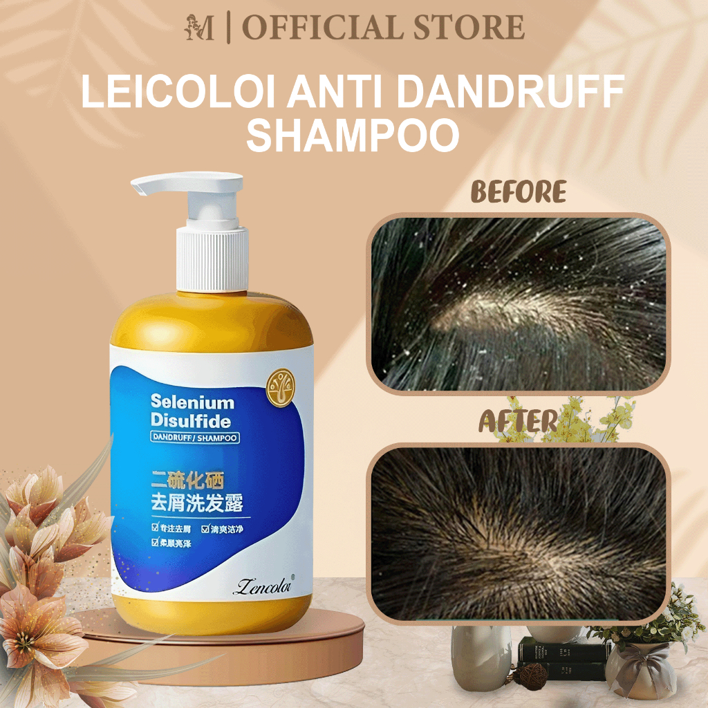 Jual Shampo anti gatal Shampo dermatitis seboroik Shampo radang folikel ...