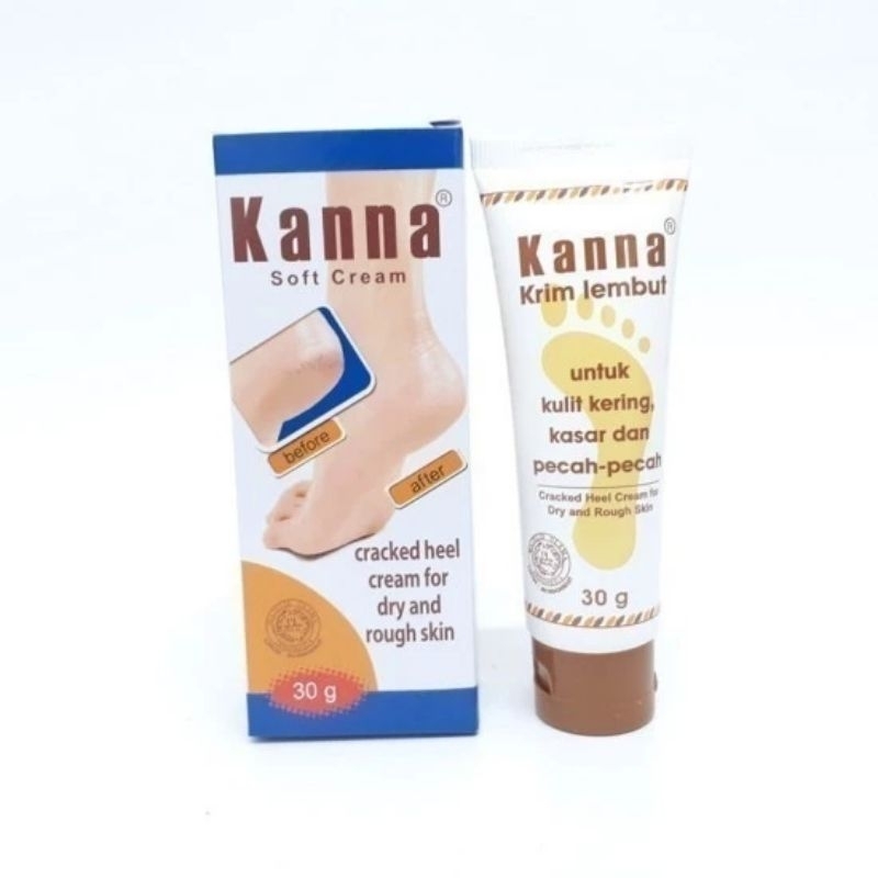 Jual Kana soft cream kaki pecah-pecah | Shopee Indonesia